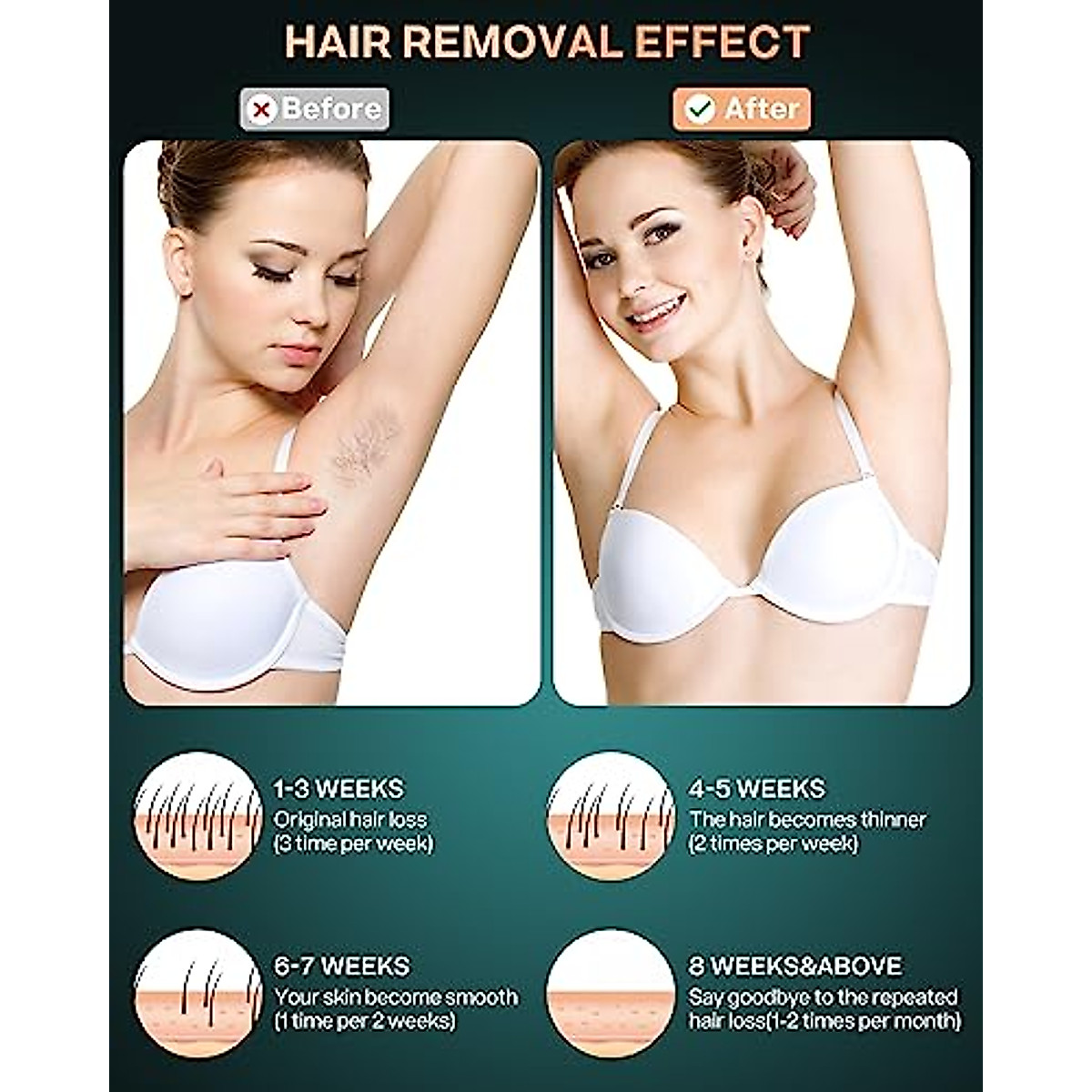 OUBABO IPL Hair Removal for Women and Man, Laser Hair Removal Device with Ice Cooling Care, at-Home Permanent Hair Reduction for Facial Armpits Legs Bikini Line Whole Body, Come with Razor and Goggles