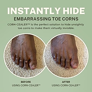 CORN-CEALER | Toe Corn Makeup | Instantly Hide Toe Corns | Concealer For Toe Corns (Shade-NUTMEG)