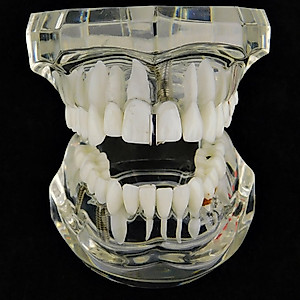 Gap Grillz Silver Tone Single Plain Tooth Top or Bottom Teeth Single Hip Hop Grills