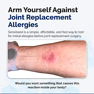 SENSIBAND Metal Allergy Test Band – Test at Home or Anywhere - Tests for Common Metals Used in Piercings & Jewelry - See Your Own Results - Order 3 Weeks Before Surgery.… (Copper)