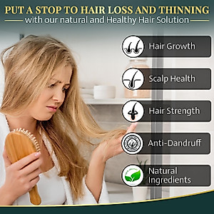 Aroma Dead Sea Black Mud Shampoo - Fights Dandruff, Thinning Hair, Weak Roots & Itchy Scalp. Prevents Hair Loss & Encourages Growth. Ideal for Damaged Hair (12.85 fl.oz)