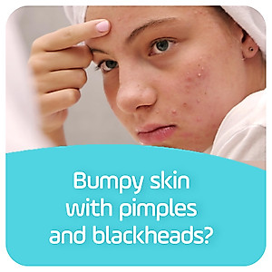 Asepxia Cleansing Bar Scrub, 4 Ounce Multipack (Pack of 5)