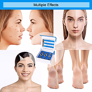 Diamond Dermabrasion Head Microdermabrasion Exfoliator Home Facial Dermabrasion Tool Dermabrasion Replacements 9Tips