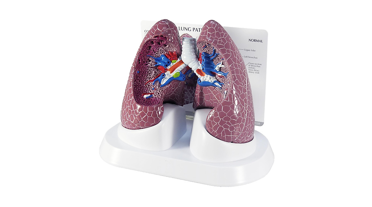Lung Model Set | Human Anatomy for Medical and Educational Use