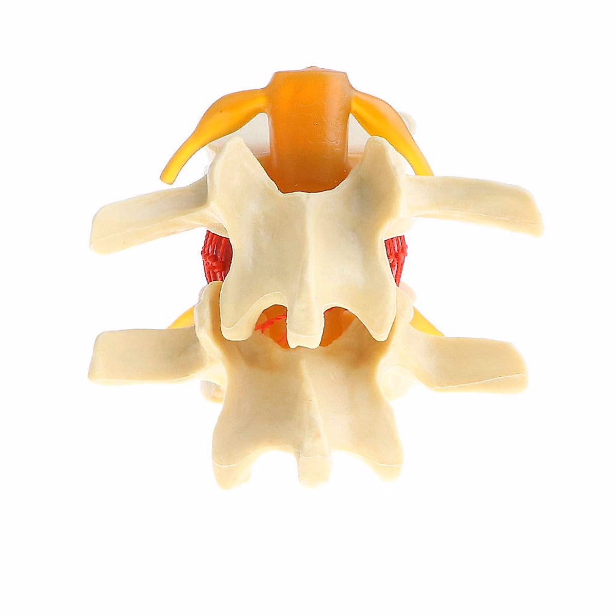 BONEW 4PCS Magnify 2X Human Spine Lumbar Vertebrae Degenerative Disc Medical Model