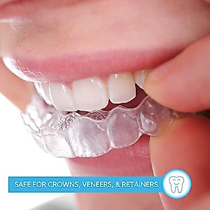 GO SMILE On The Go Teeth Whitening Pen, Teeth Whitener & Stain Remover Self Care Gifts for Women & Men - Whitening Strips Alternative - Travel Size for Gift Basket or Stocking Stuffers, Mint, 1.3mL