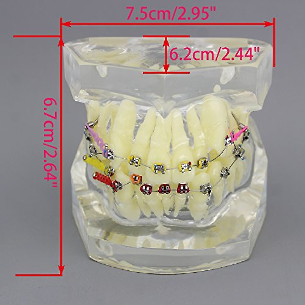 Smile1000 Dental Malocclusion Orthodontic Treatment Teeth Model with Metal Brackets Wires Colorful Ties Chains and Hoops M3005