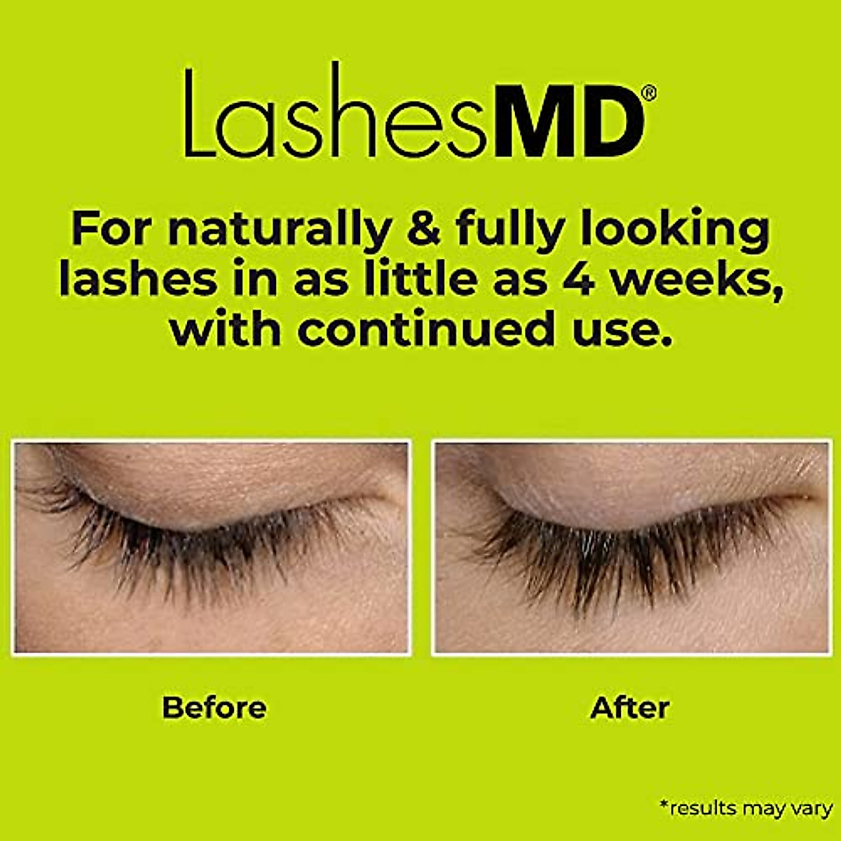 LashesMD Eyelash Growth Serum & Conditioner, 0.135 oz. – Naturally Enhances for Stronger, Thicker Lashes & Brows – Paraben & Cruelty Free – Clinically Formulated with Peptides & Botanicals