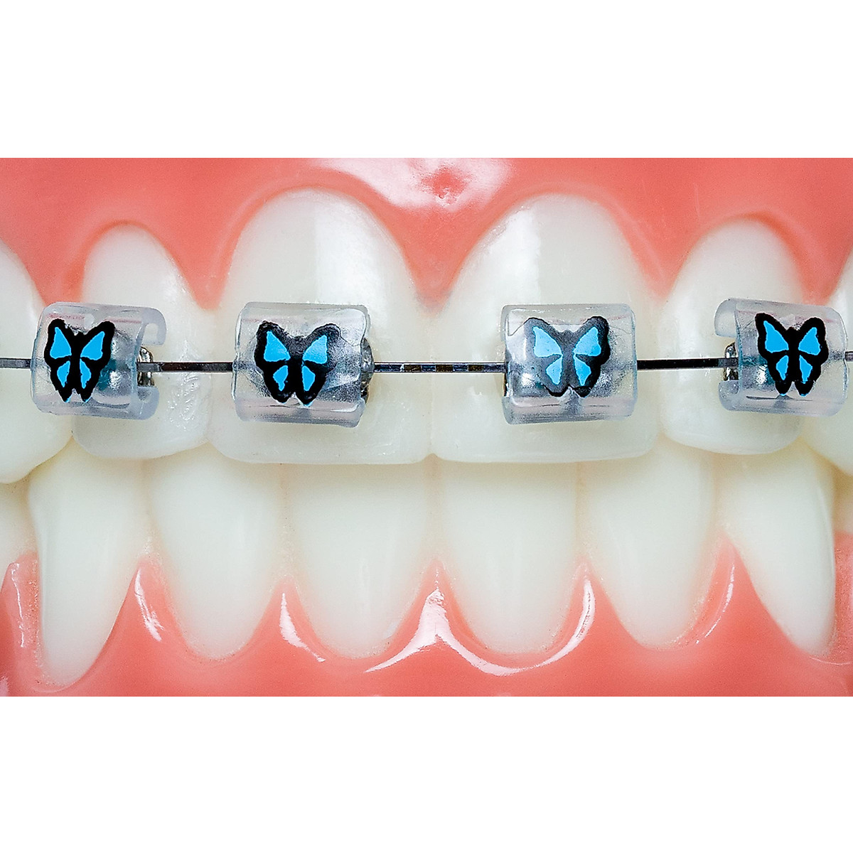 Snapcaps Braces Bumper Cover, Orthodontic Bracket Wax Substitute, Alternative Snap-on Braces Guard Braces Accessories 10 pack (Butterfly)