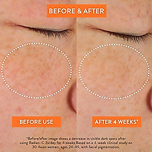 LANEIGE Radian-C Cream: Hydrate, Visibly Brighten & Reduce Look of Dark Spots with Vitamin C EAE & Vitamin E, 1.0 fl. oz.