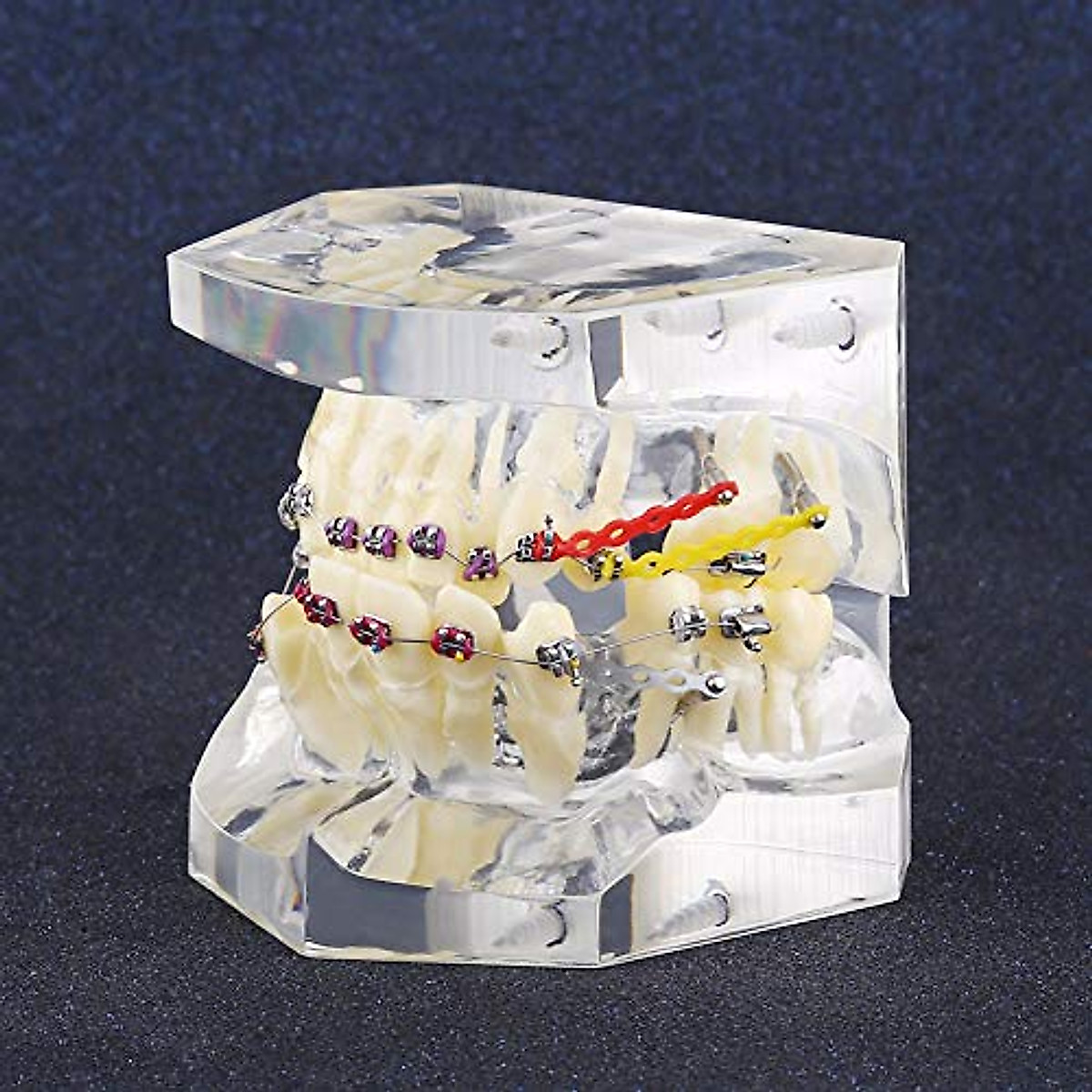 Teeth Educational Model Dental Treatment Malocclusion Study Demonstration Teeth Model with Wire Chain Orange