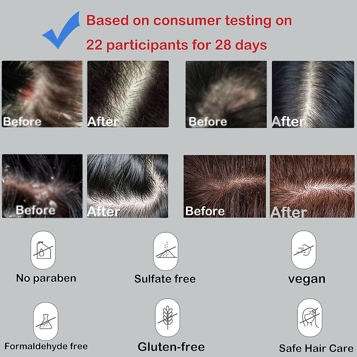 Voir Haircare Rhythm of the Rain Calming Glacial Leave-in Scalp Serum 1.0 Fl Oz