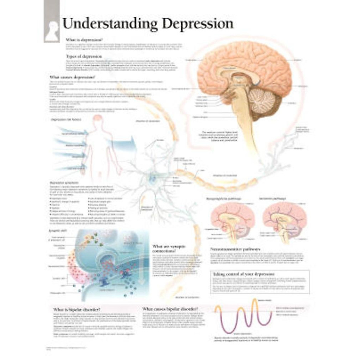 Understanding Depression chart: Wall Chart
