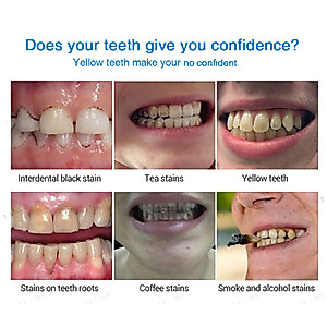 3PCs Frosty Neptune Teeth Whitening Pen,Teeth Whitening Essence,Teeth Whitening Gel,Teeth Stain Remover to Whiten Teeth,Intensive Stain Removal Teeth Reduce Yellowing