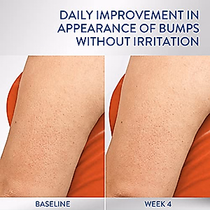 CETAPHIL Daily Smoothing Moisturizer for Rough and Bumpy Skin | 10 fl oz | For Sensitive Skin | Urea Cream Hydrates and Exfoliates to Smooth Skin | Fragrance Free | Dermatologist Recommended