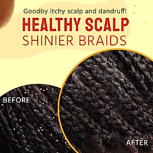 Glammed naturally oil - Braid Oil, Braid Oil for Itchy Scalp and Dry Scalp, Braid Care Oil for Dandruff, Lice and Thinning Edges, 2 Oz