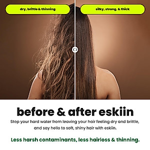 Eskiin Shower Head Water Filter Replacement For The Eskiin Showerhead - High Pressure Shower Heads Replacement For Smooth Hair & Skin - Replacement Cartridge Fits The Eskiin Filtered Shower Head