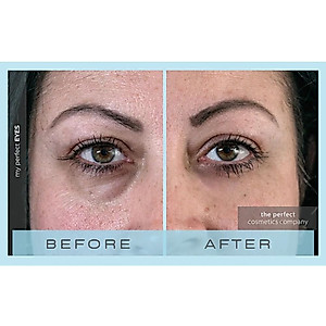 My Perfect Eyes 10ml, 100 Applications, Penny Lane, Instant Results, Clinically Proven, Anti-Ageing Serum UK Original Formula, Science-Backed Anti-Wrinkle Serum. As Seen on TV.