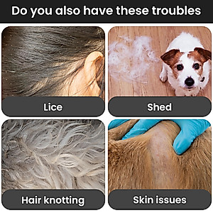 Lice Removal Comb Kit 7 Pcs, Flea and Tick Comb Lice Treatment, Stainless Steel Thread Dandruff Comb, Nit Combs for Thick Hair, Kids, Adults & Pets