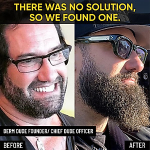 Derm Dude Mega Beard Growth Oil with Jojoba Oil, Japanese Peppermint Oil, Castor Oil, Avocado oil and more. Promotes Natural Healthy Facial Hair Growth for Men, Thickening and Conditioning Beard Oil