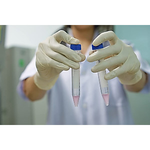 Ackers Conical Centrifuge Tubes 15mL, 100 Pcs Sterile Plastic Test Tubes with Screw Caps, Polypropylene Container with Graduated and Write-on Spot, Non-Pyrogenic, DN/RNase Free