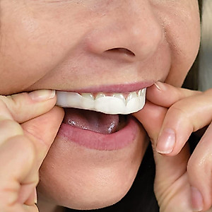 SleepRight ProRX Dental Guard, Ultra-Thin, Custom-Fit, Durable for Teeth Grinding, Comfortable for Sleeping (New Version)