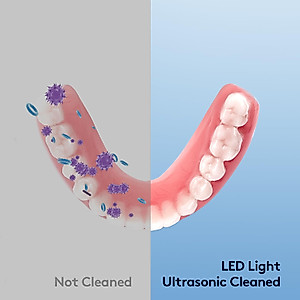 Ultrasonic U-V Cleaner for Dentures, Retainer, Mouth Guard, Aligner, Whitening Trays, Toothbrush Head, 45kHz Ultrasonic Retainer Cleaner Machine for All Dental Appliances, Jewelry, Diamonds