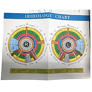 Iriscope Iridology Camera 5.0 MP LED Light Iris Analyser Iridoscope iriscopio
