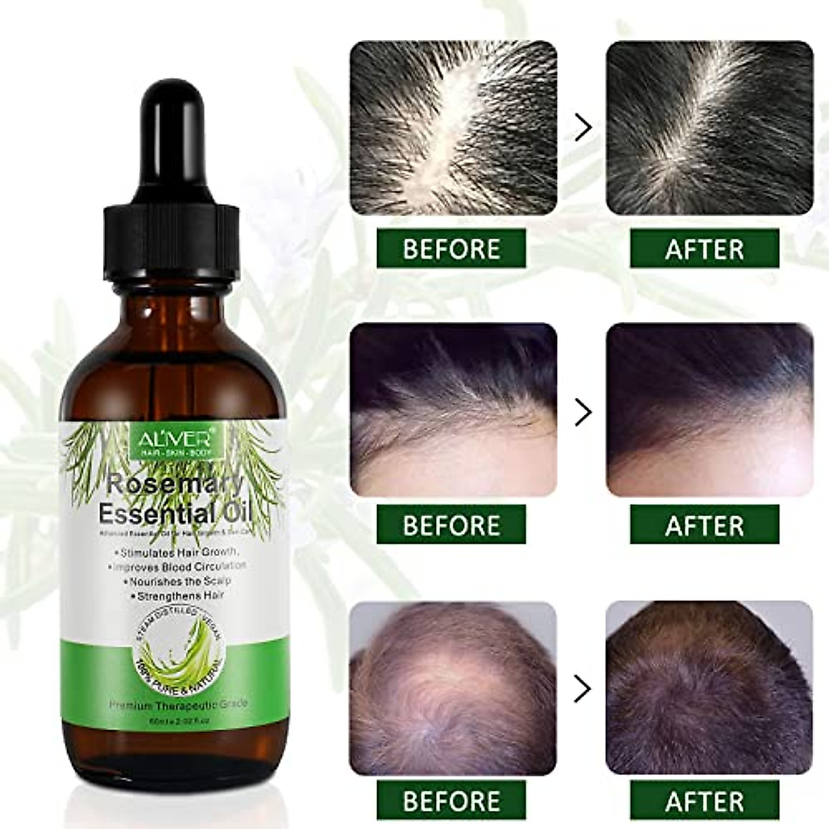 Rosemary Oil for Hair Growth,Rosemary Essential Oil for Hair Loss Regrowth Treatment,Strengthens Hair,Nourishes Scalp,Light Weight,Non Greasy,Improves Scalp Circulation For Men And Women 2.02 Oz