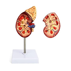 QWORK Life-Size Kidney Model, Divided into 2 Parts Showing Internal Structure A Normal Kidney Human Anatomy Replica for Doctors Office Educational Tool