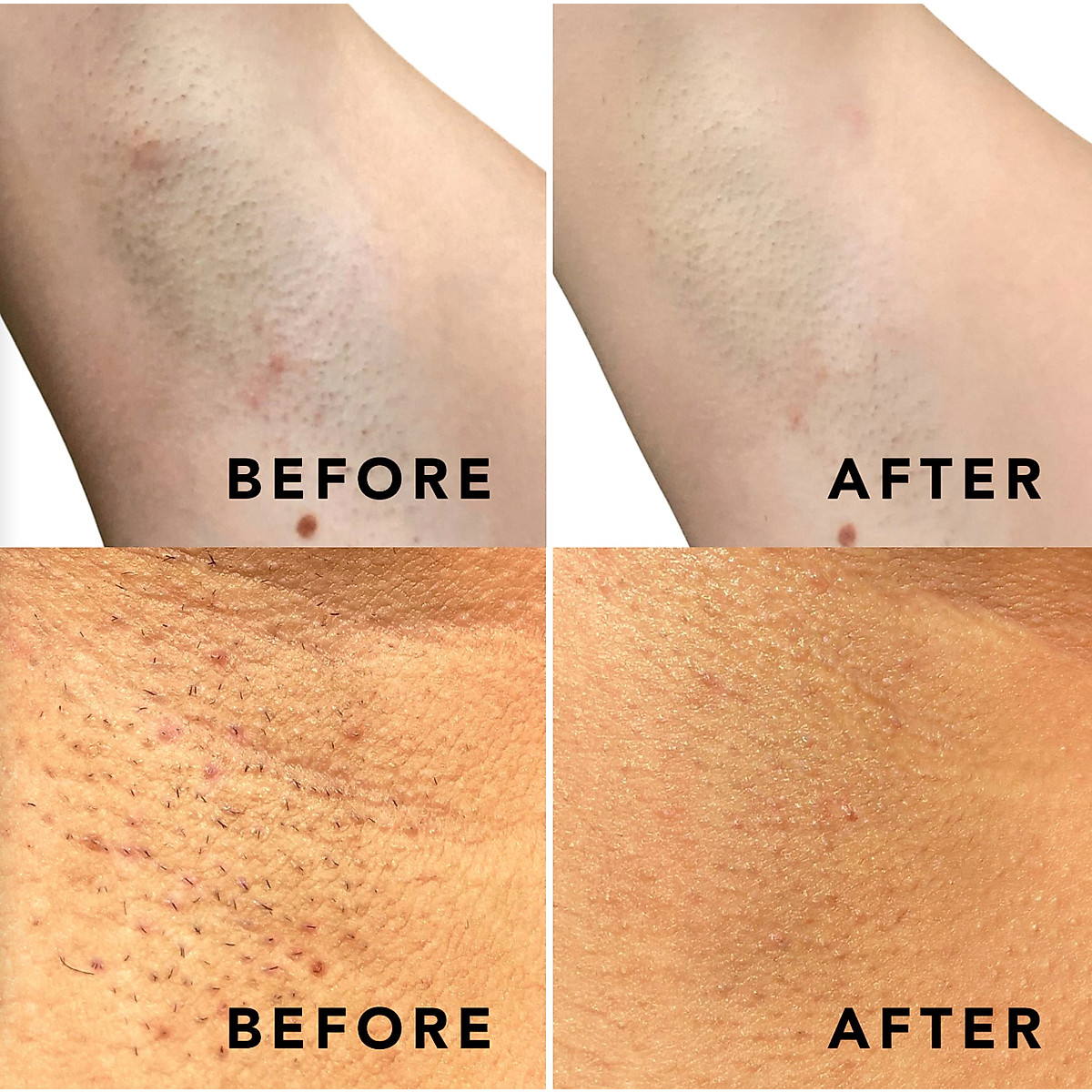 SweetSpot Labs Buff & Brighten, Daily Ingrown Hair Treatment Pads with BHA and AHA, Safe for Bikini Area, 50 Exfoliating & Brightening Wipes