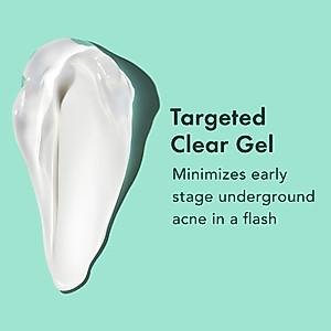 Rael Acne Spot Treatment, Miracle Clear Soothing Spot Gel Pen - Acne Gel, Pimple and Blemish Treatment, Korean Skincare, for Early Stage, Succinic Acid, Tea Tree, Cica, Vegan, Cruelty Free (0.14 oz)