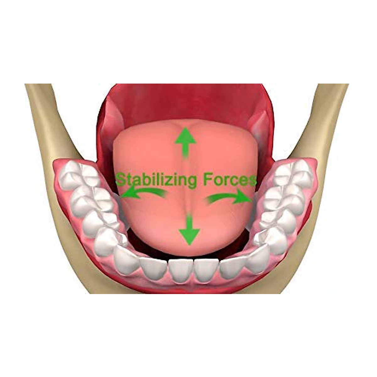 Lower Denture Stabilizers
