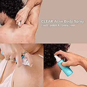 Paula's Choice CLEAR Back & Body Acne Spray, 2% BHA (Salicylic Acid) Treatment for Bacne, Blackheads & Blemishes, 4 Ounce