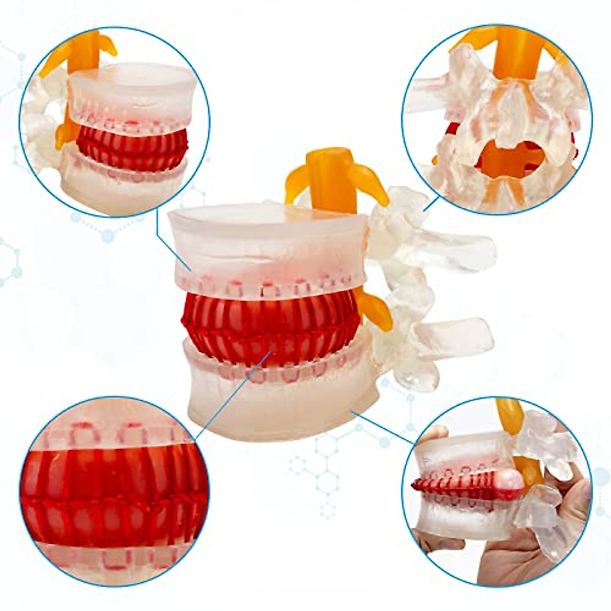 SKUMOD Human Lumbar Disc Herniation Model, Transparent Lumbar Spine Model, Lumbar Disc Anatomical Model with Elastic Software