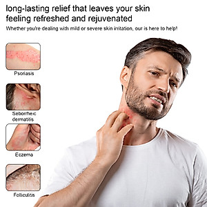 UEUEKOKO Eczema Psoriasis Manuka Relief Honey Cream, Hand Foot, Tinea Versicolor, Itchy Feet, Butt, Anal Itch, Scalp Dandruff, Bee Sting, Bites, Boil Cyst, Armpit, Adults Kids, Hidradenitis Treat