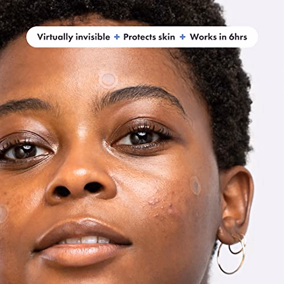 Mighty Patch Variety Pack from Hero Cosmetics - Hydrocolloid Acne Pimple Patches for Covering Zits and Blemishes, Spot Stickers for Face and Skin, Vegan-friendly and Not Tested on Animals (26 Count)