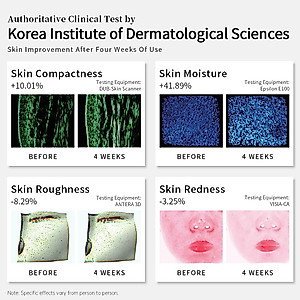 HIME SAMA Led Face Mask, Red Light Mask for Face, FSA/HSA Eligible, Infrared, Red & Blue Light Mask for Skin Care, Wrinkle Reduction, Wireless Face Mask. (Miracle STAR RB-010)