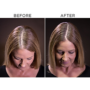 Hairatin Premium Root Touch Up | Cover Up Gray Hairs & Roots | Works Instantly & Water Resistant | Thicker Looking Hairlines Between Salon Trips | Root Concealer Without Salon Spray – Dark Brown