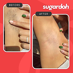 Sugardoh Sugar Waxing Kit for Women As Seen On Shark Tank (Vintage Kit Medium) - Face, Arms, & Legs - Sugar Wax Hair Removal - Sugaring Tiktok Products - Bikini Wax Kit for Women - Sugaring Kit