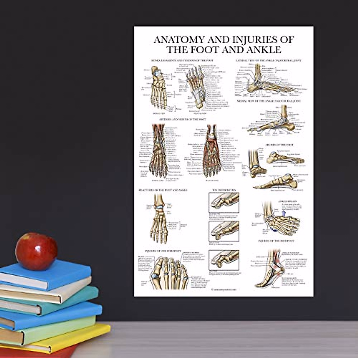 Palace Learning 2 Pack - Anatomy and Injuries of the Hand & Wrist + Anatomy and Injuries of the Foot & Ankle - Set of 2 Anatomical Charts - Laminated 18" x 24"