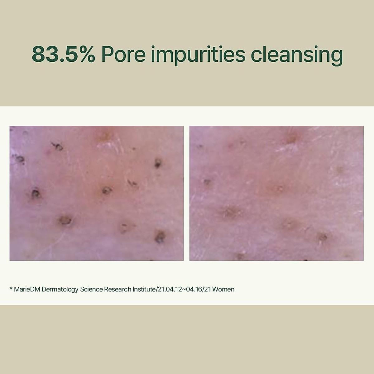 Pyunkang Yul Calming Low pH Foaming Cleanser | Daily Face Wash & Makeup Remover with Tea Tree, Centella Asiatica, 5 Hyaluronic Acids that Removes Dead Skin Cells, Hydrates Skin - 150ml 5.07 Fl.Oz.