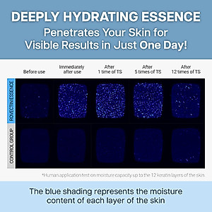 ROVECTIN Aqua Hyaluronic Essence (Activating Treatment Lotion) - 7 Layers Hyaluronic Acid Facial Toner with Niacinamide & Panthenol, Vegan Korean Skin Care (6.08 fl.oz)