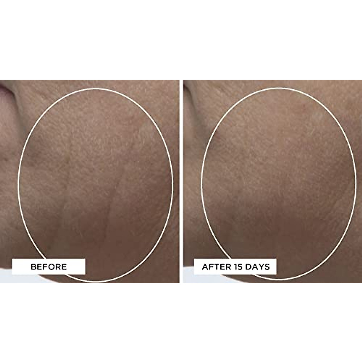 Perricone MD High Potency Classics: Hyaluronic Intensive Moisturizer 1 Fl Oz (Pack of 1)