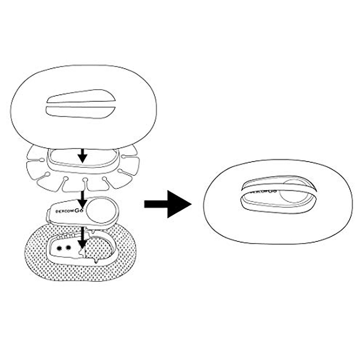 The Clear G6 Shield for Your Dexcom Over Patches Diabetic Accessory | Reusable and Washable | Great Gift for a Diabetic Child or Adult