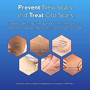 ScarAway Silicone Scar Gel, Helps Improve Size, Color & Texture of Hypertrophic & Keloid Scars from Injury, Burns & Surgery, Water Resistant, 10g (0.35 Oz)