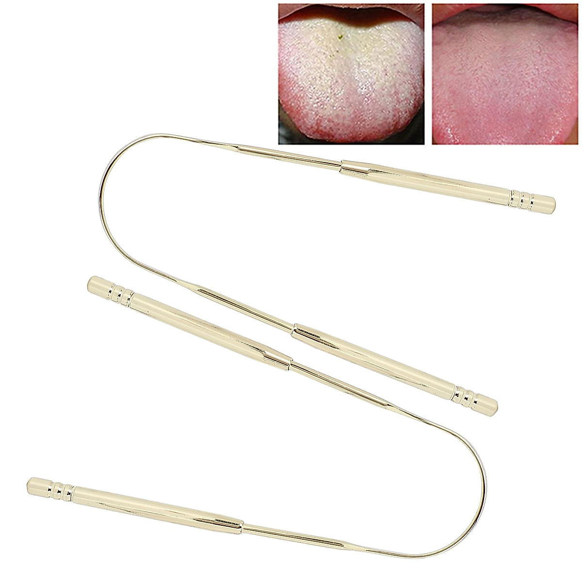 2Pcs Stainless Steel Tongue Scrape, U Shape Tongue Cleaner Oral Tongue Scraper for Oral Care Fights Bad Breath for Adults and Kids(gold)