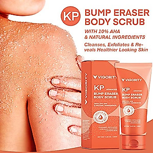 KP Bump Eraser Body Scrub, Body Exfoliating Scrub, Keratosis Pilaris Treatment, Strawberry Legs Treatment, Exfoliating Body Wash, Strawberry Skin Treatment, Scrubs for Women & Men Exfoliation - 8.45OZ