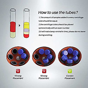 PRP Centrifuge Machine 6x10ml, Cekegon Lab Benchtop Centrifuges, Portable PRF centrifuge, 110V, 4000rpm, 0-60min for Medical Practice, Plasma, Blood, Skin Tighten, 900-2