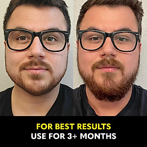 Beard Club Biotin Vitamin Spray for Facial Hair Growth - Natural Formula for Fuller, Thicker Beard, Easy-to-Use, Nourishing & Soothing for All Beard Types & Skin